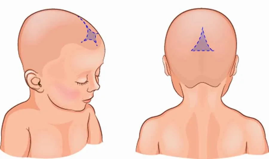 Moleiras dos bebês: onde elas estão e quais cuidados ter