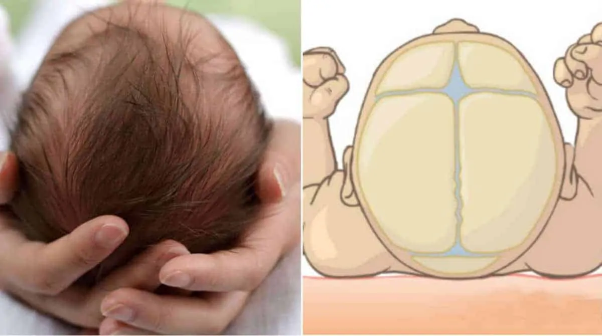 Moleiras dos bebês: onde elas estão e quais cuidados ter
