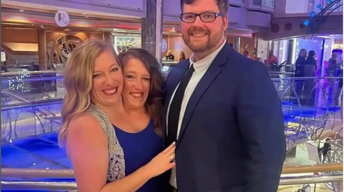 Gêmeas siamesas apresentam seu bebê em novas fotos lindas