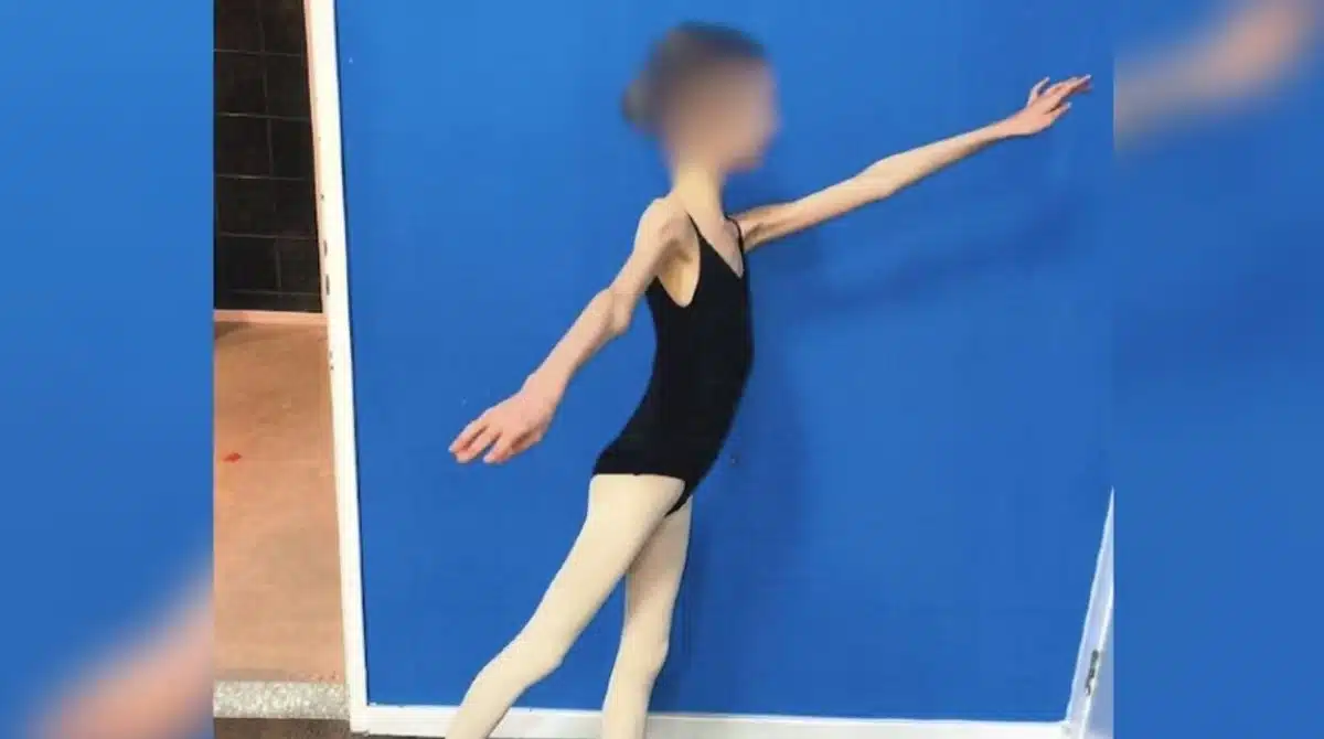 Menina desabafa após pais a deixarem assim pro balé e choca